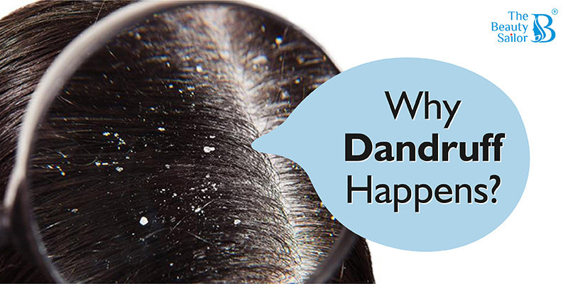 Why Dandruff Happens: Understanding The Science Behind It:The Beauty Sailor